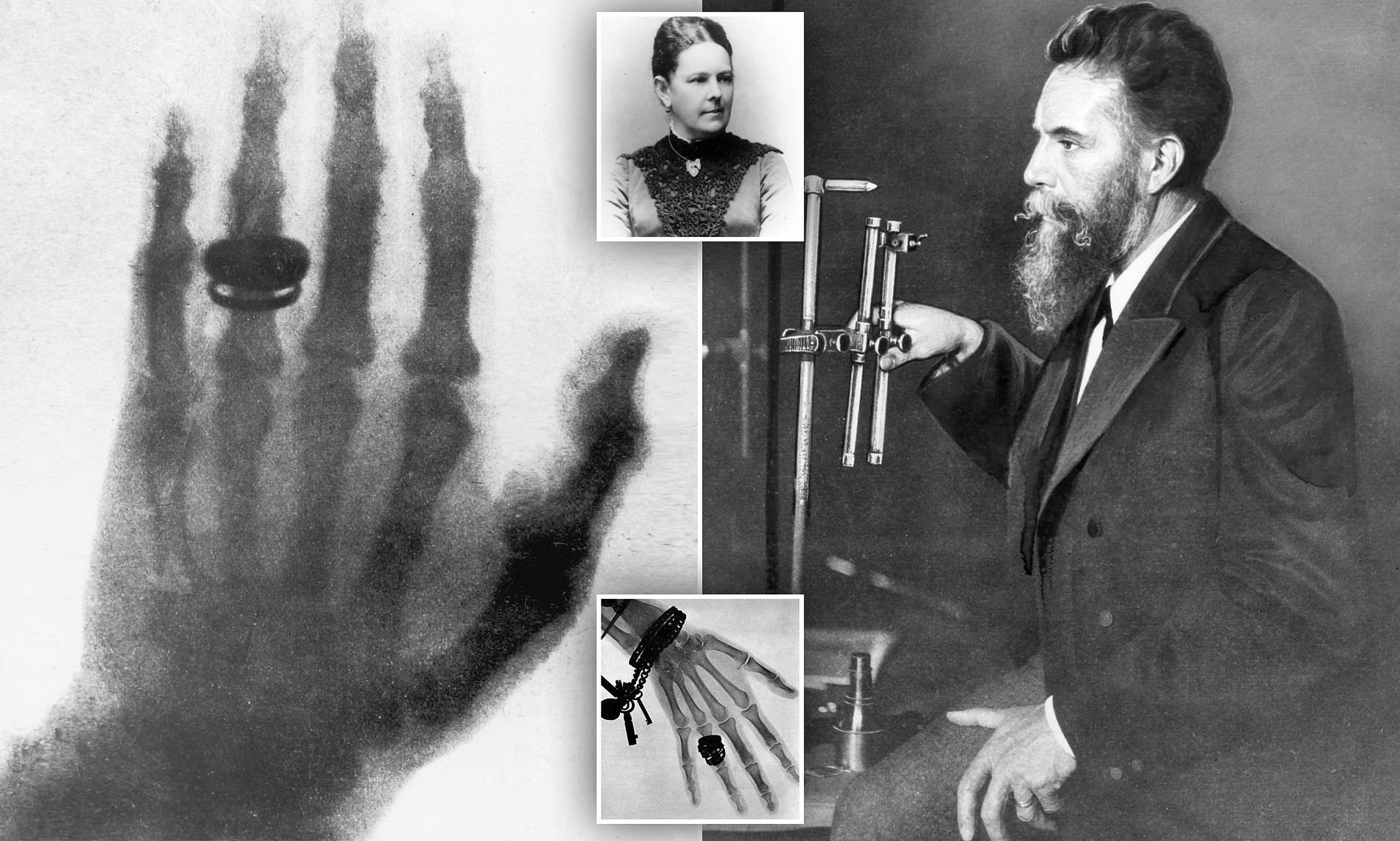 ON THIS DAY: Wilhelm Conrad Röntgen Discovers X-rays (1895) - Sigmalive ...