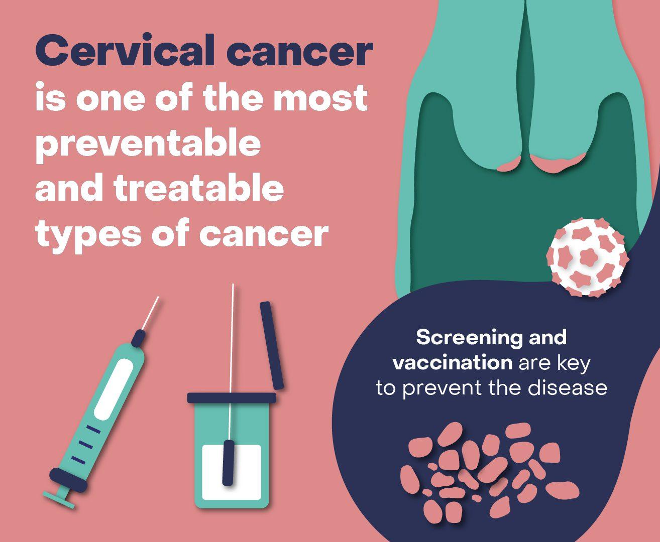HPV testing preferred over Pap for cervical cancer screening at 30 ...