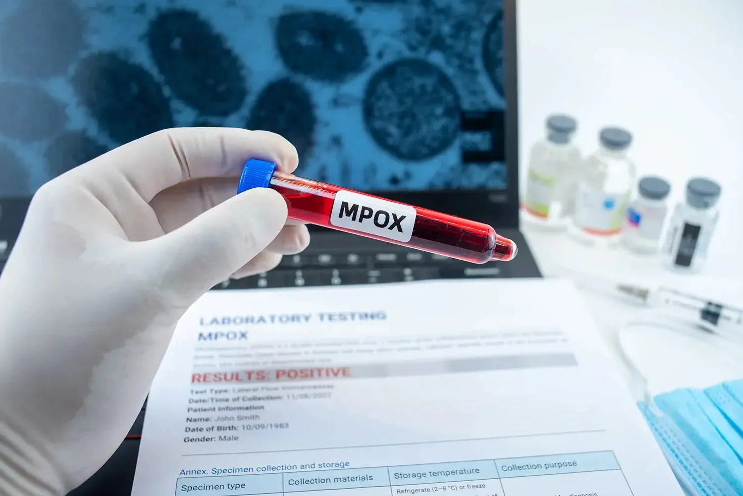 First mpox death recorded in Ghana - Sigmalive English