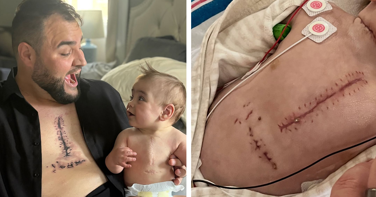 Father makes tattoo scar tribute to support son - Sigmalive English